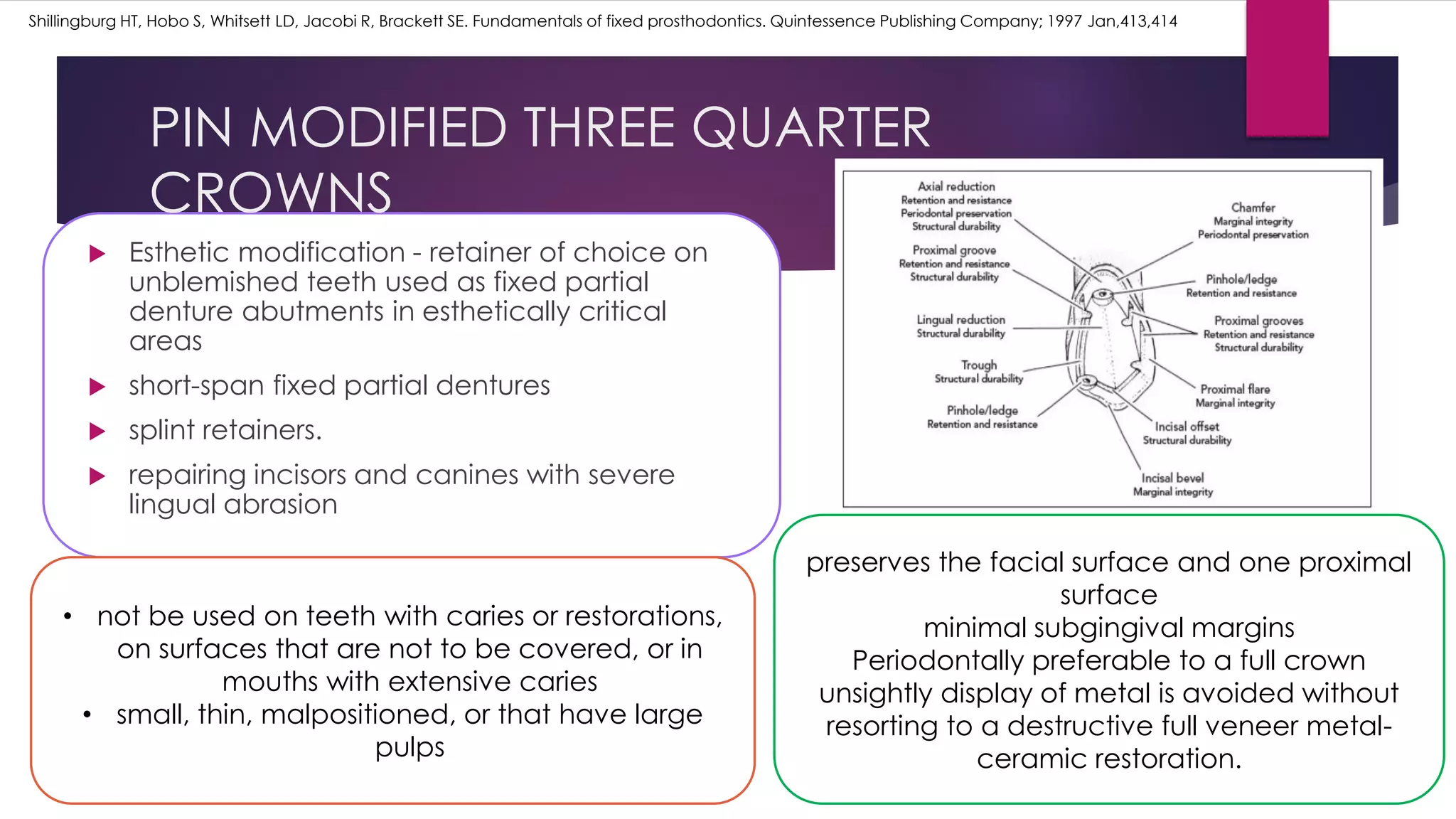 Retainers in FPD (FIXED PARTIAL DENTURES) PDF copy | PDF