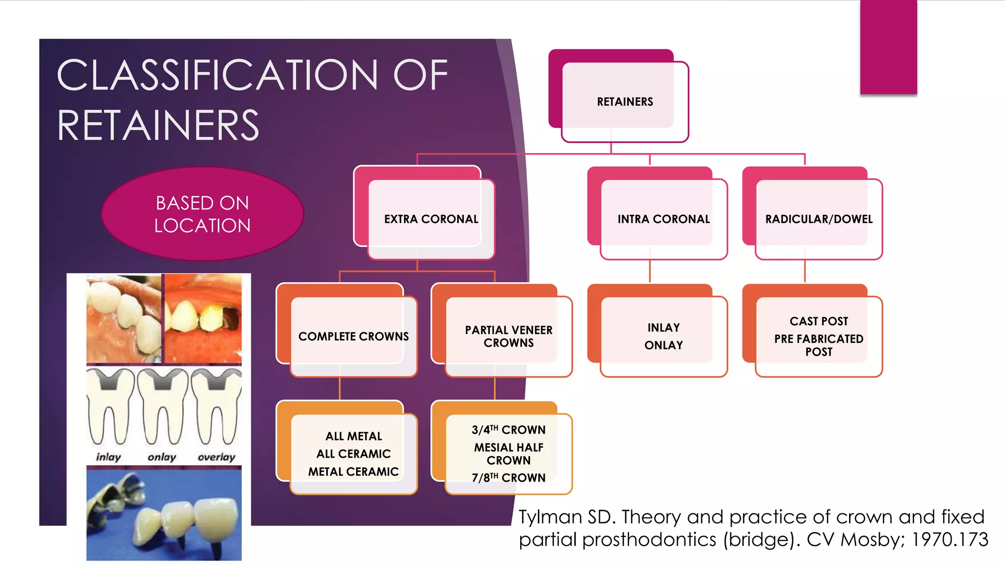 Retainers in FPD (FIXED PARTIAL DENTURES) PDF copy | PDF