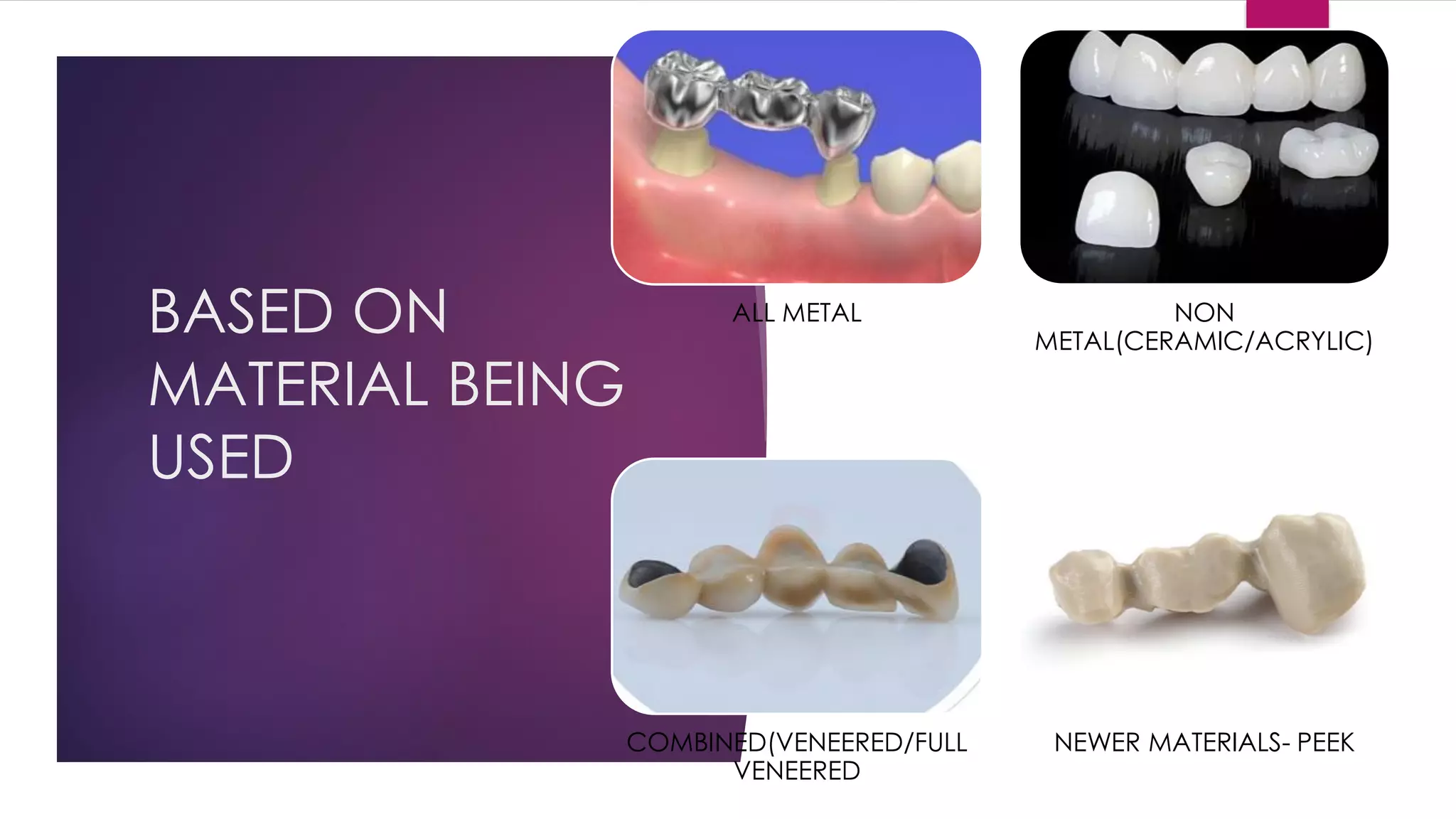 Retainers in FPD (FIXED PARTIAL DENTURES) PDF copy | PPT