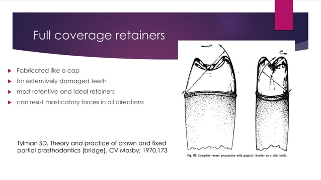 Retainers in FPD (FIXED PARTIAL DENTURES) PDF copy | PDF | Dental ...