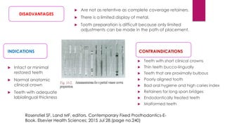 Retainers in FPD (FIXED PARTIAL DENTURES) PDF copy | PDF