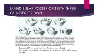 Retainers in FPD (FIXED PARTIAL DENTURES) PDF copy | PDF