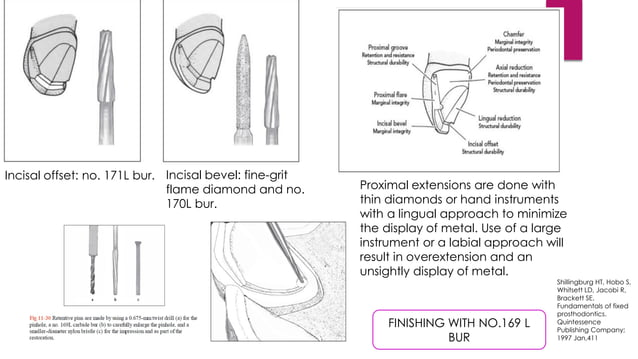 Retainers in FPD (FIXED PARTIAL DENTURES) PDF copy | PDF | Dental ...