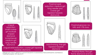 Retainers in FPD (FIXED PARTIAL DENTURES) PDF copy | PDF