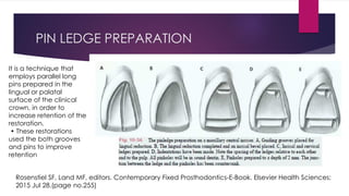 Retainers in FPD (FIXED PARTIAL DENTURES) PDF copy | PDF