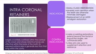 Retainers in FPD (FIXED PARTIAL DENTURES) PDF copy | PDF