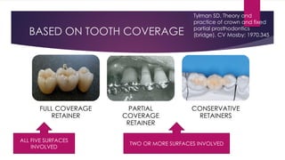 Retainers in FPD (FIXED PARTIAL DENTURES) PDF copy | PDF