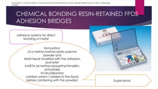 Retainers in FPD (FIXED PARTIAL DENTURES) PDF copy | PDF