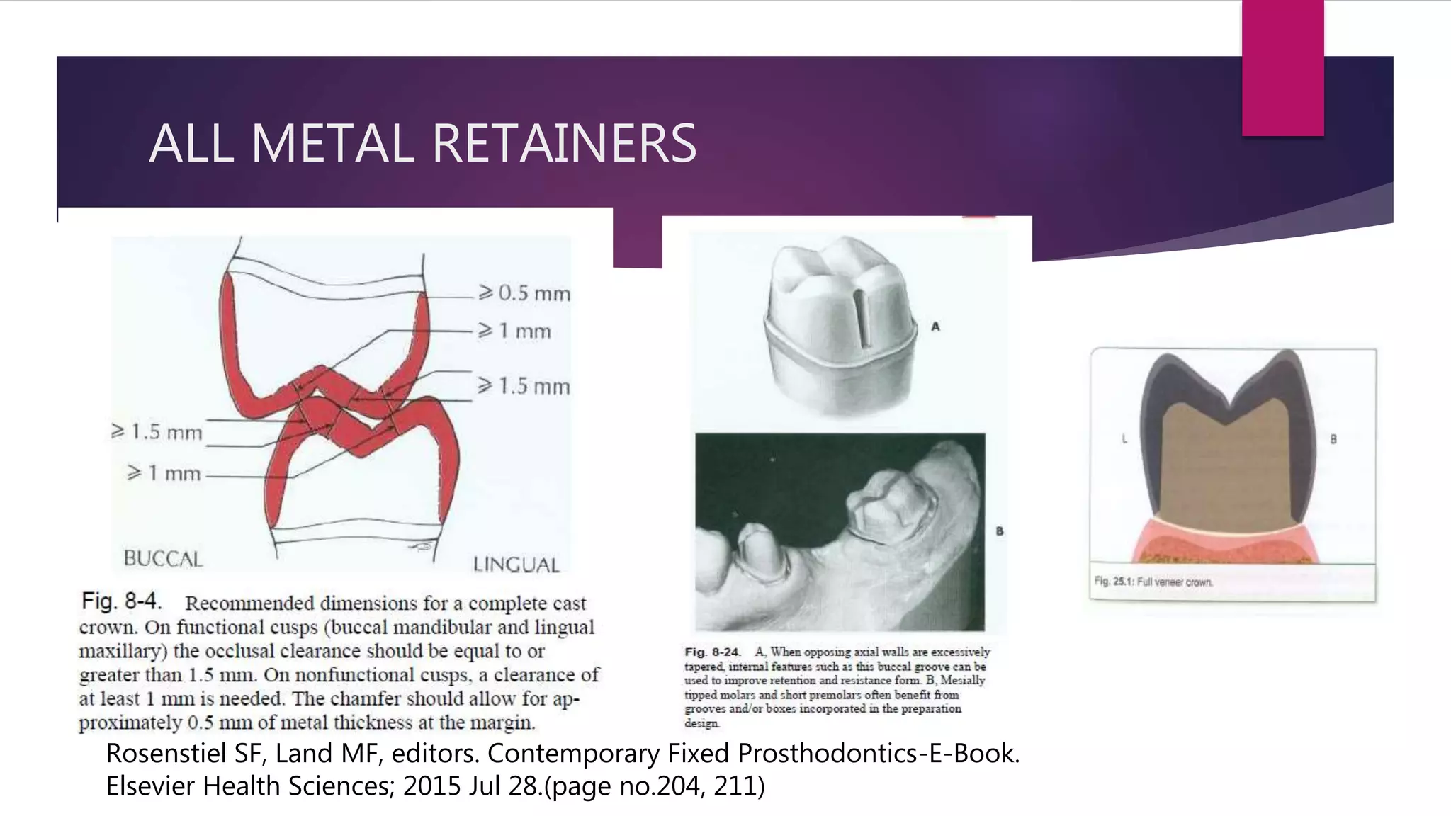 Retainers in FIXED PARTIAL DENTURES(FPDS) AND RESIN BONDED FPD | PPTX