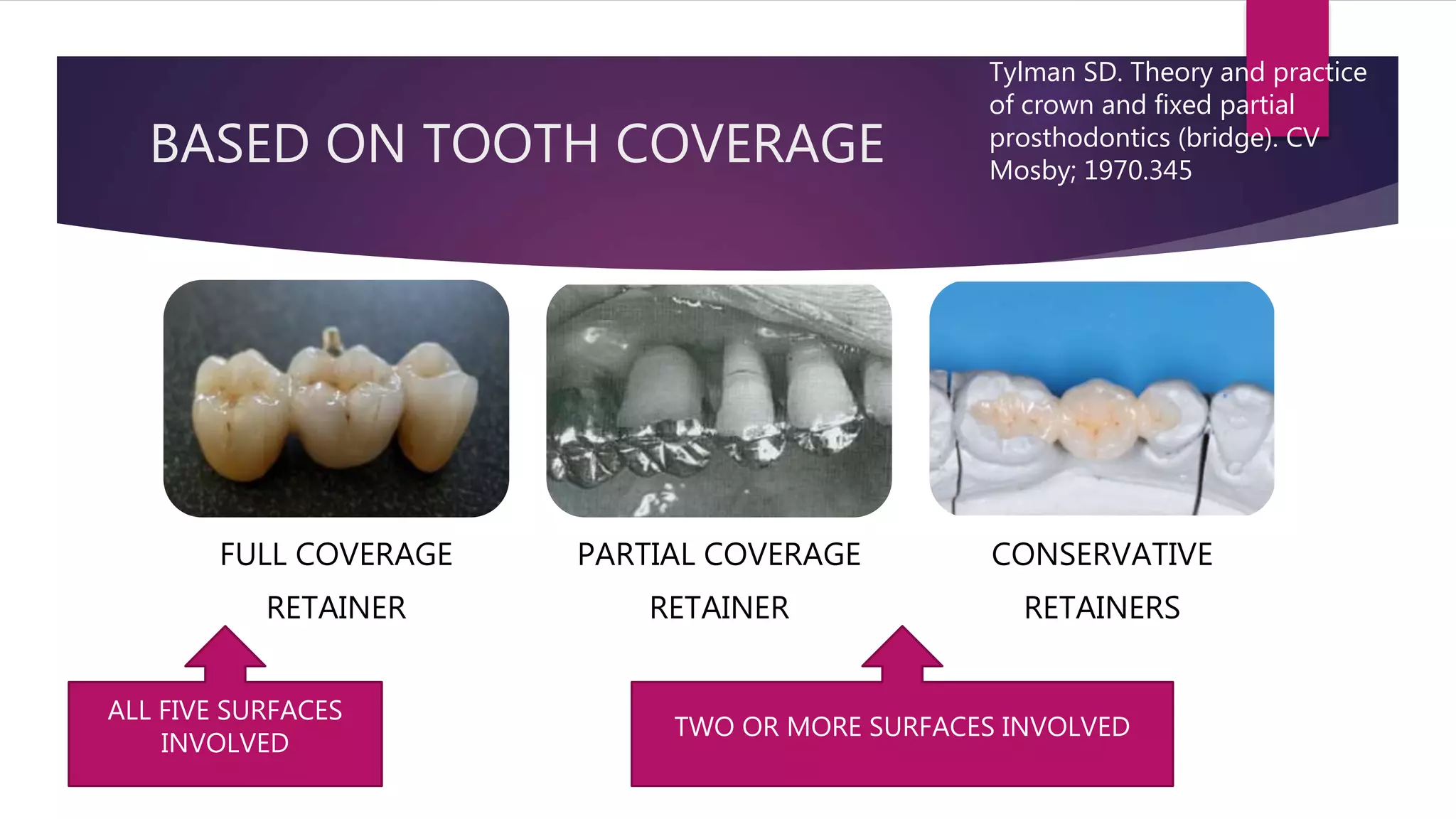 Retainers in FIXED PARTIAL DENTURES(FPDS) AND RESIN BONDED FPD | PPTX