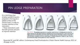 Retainers in FIXED PARTIAL DENTURES(FPDS) AND RESIN BONDED FPD | PPTX