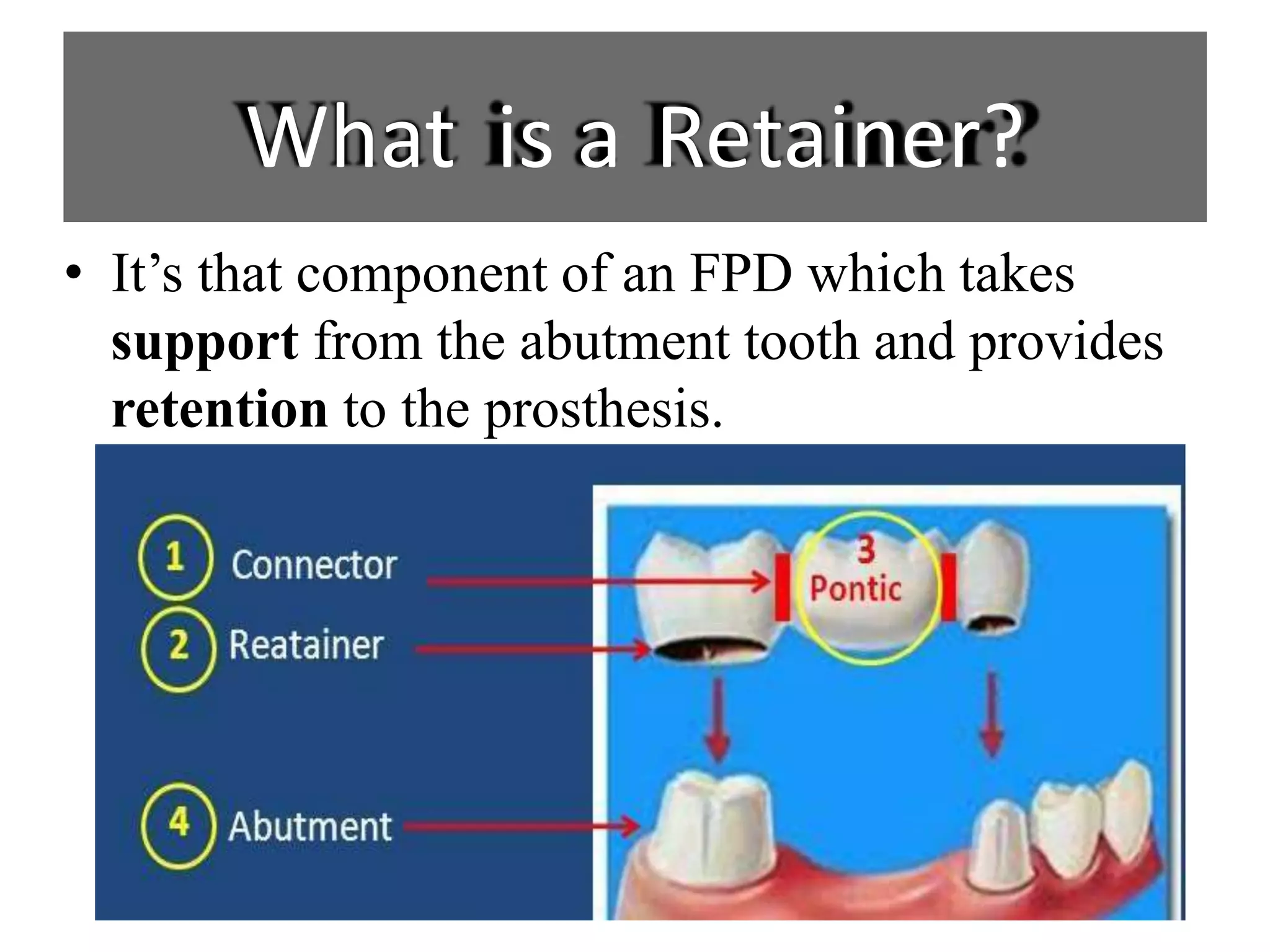 Retainers in fpd | PPT