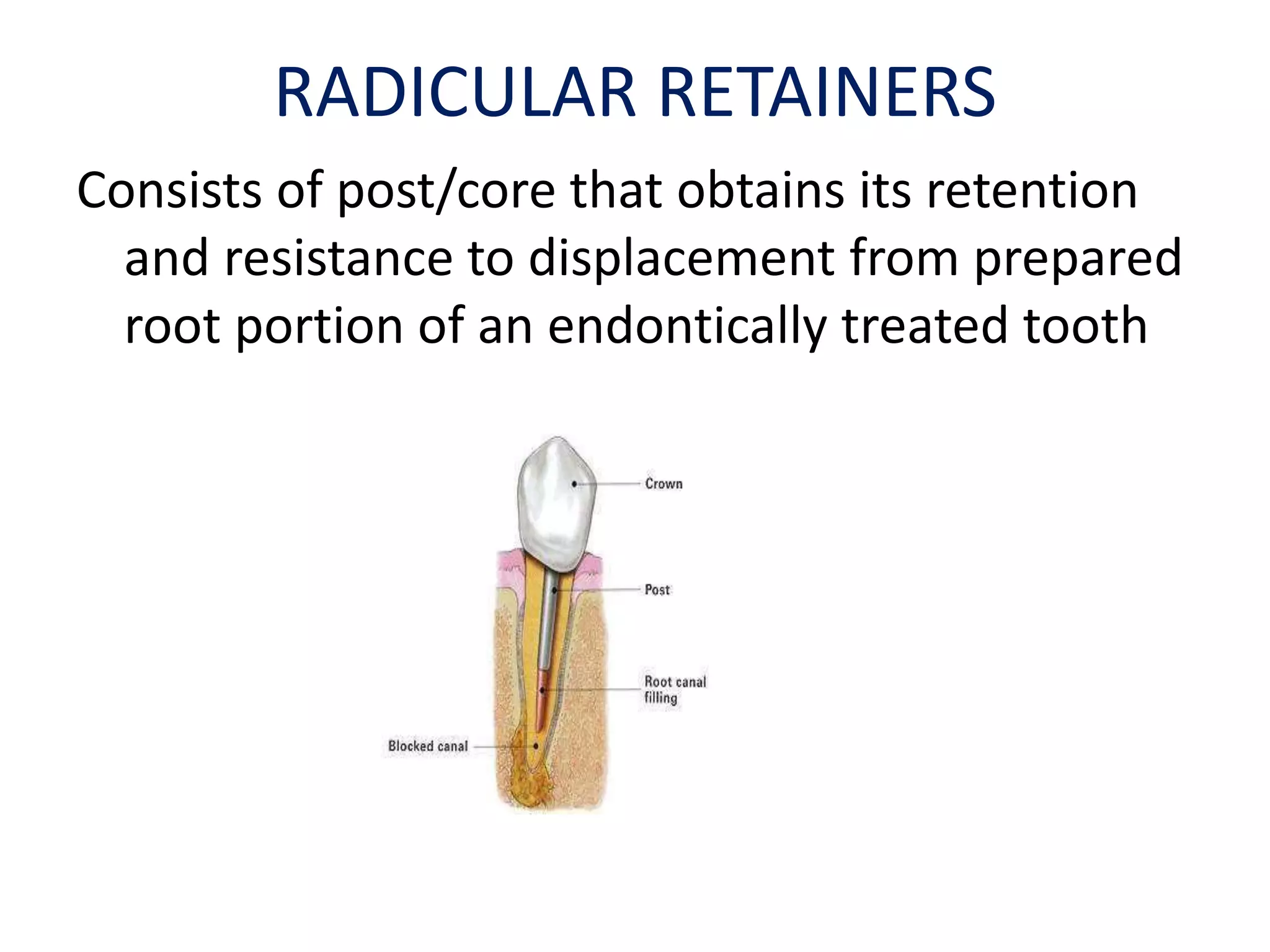 Retainers in fpd | PPT