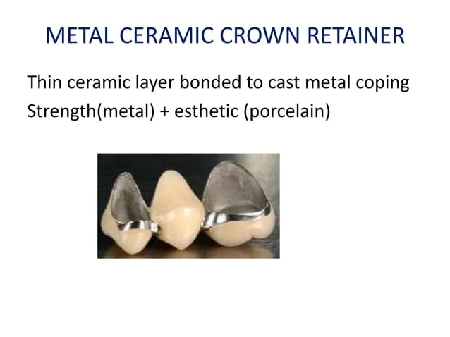 Retainers in fpd | PPT | Dental Health | Diseases and Conditions