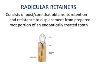 Retainers in fpd | PPT