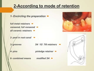 RETAINERS USED FOR FIXED PROSTHODONTICS.ppt
