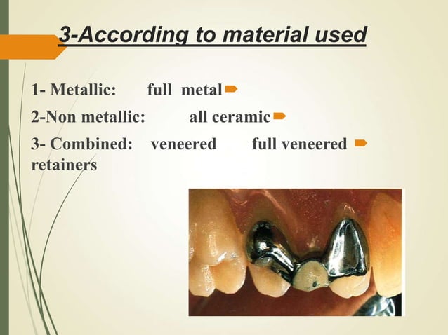 RETAINERS USED FOR FIXED PROSTHODONTICS.ppt