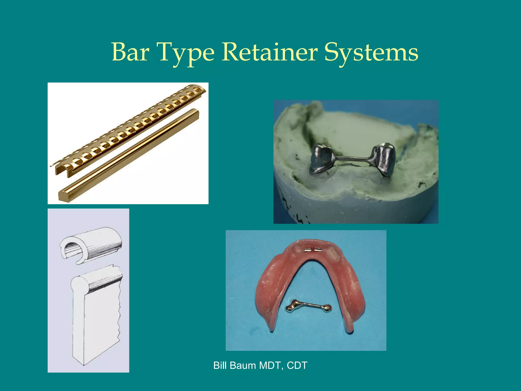 Removable Partial denture Retainer Systems | PPT