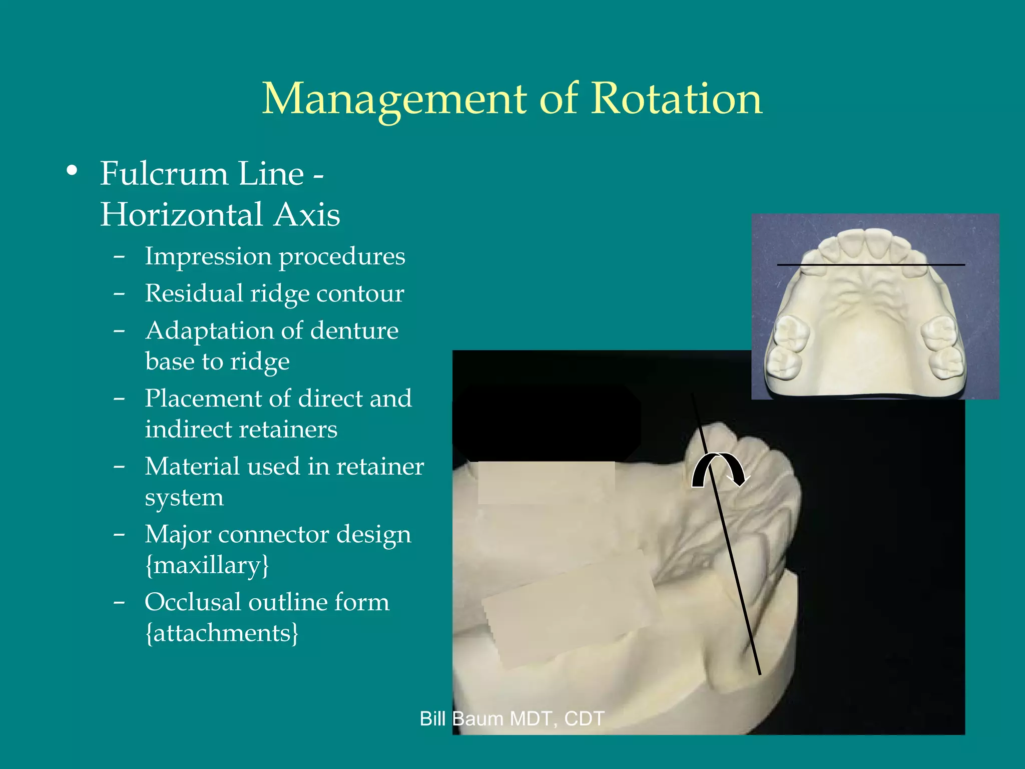 Removable Partial denture Retainer Systems | PPT