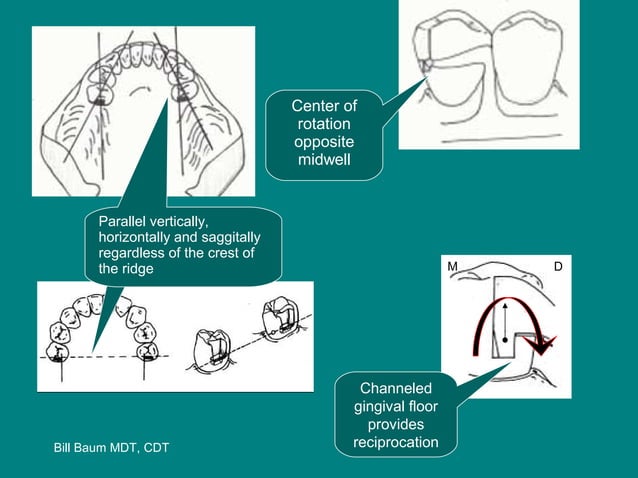Removable Partial denture Retainer Systems | PPT | Dental Health ...