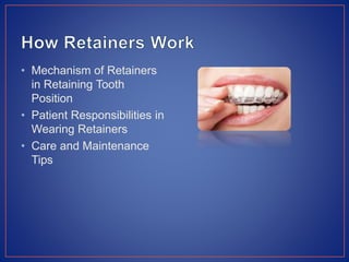 Your Retainers Are The Key To Locking In your Beautiful Smile. | PPTX