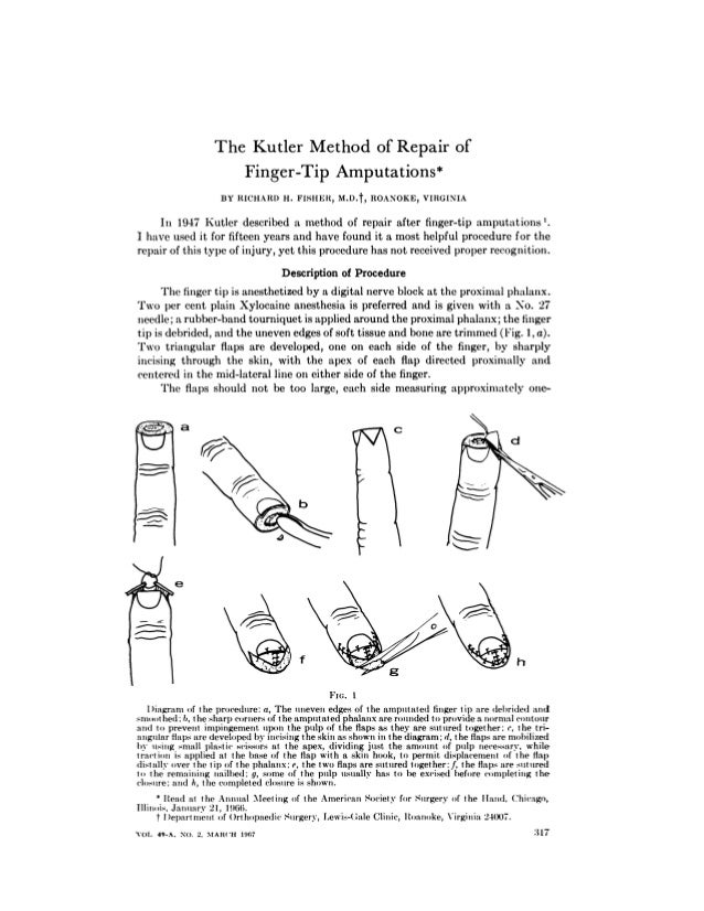 Retalho de Kuttler | PDF