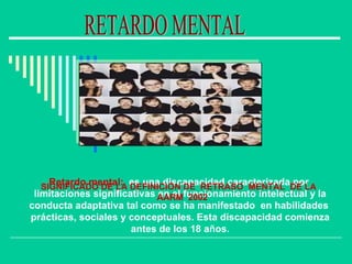 Retardo Mental | PPT