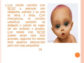 Retardo del crecimiento intrauterino | PPTX
