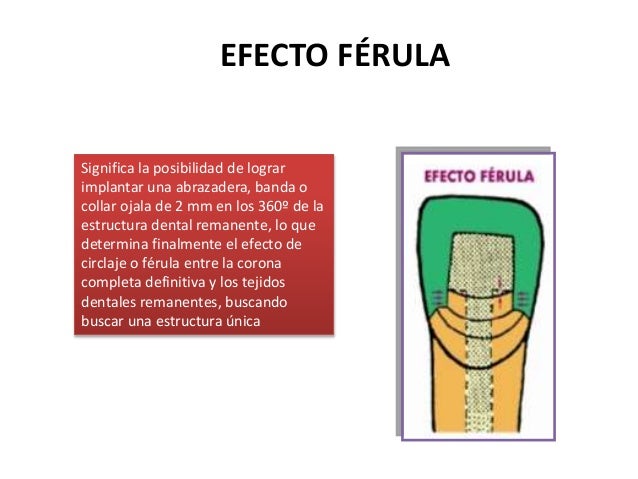 Retenedores intraradiculares en odontologia