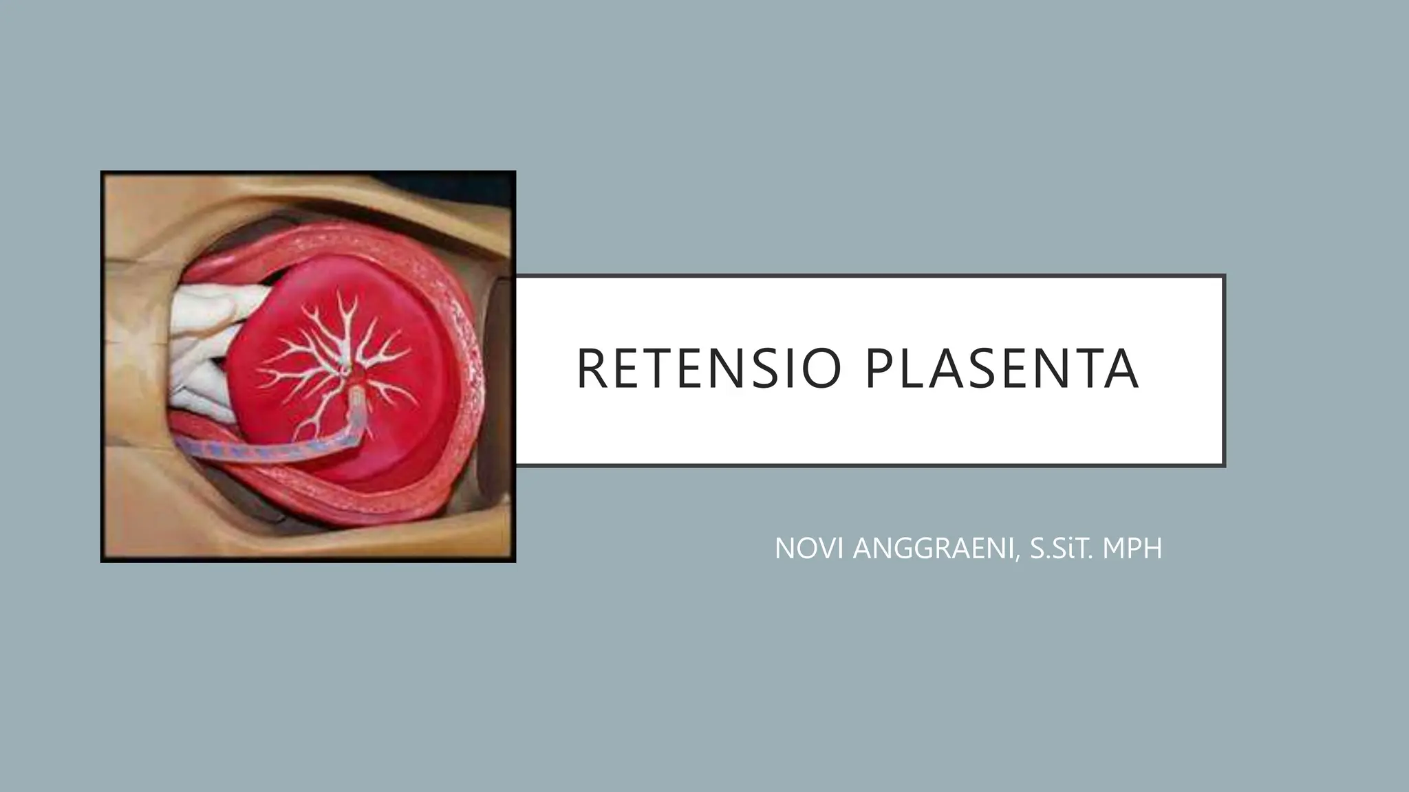 RETENSIO PLASENTA.pptx