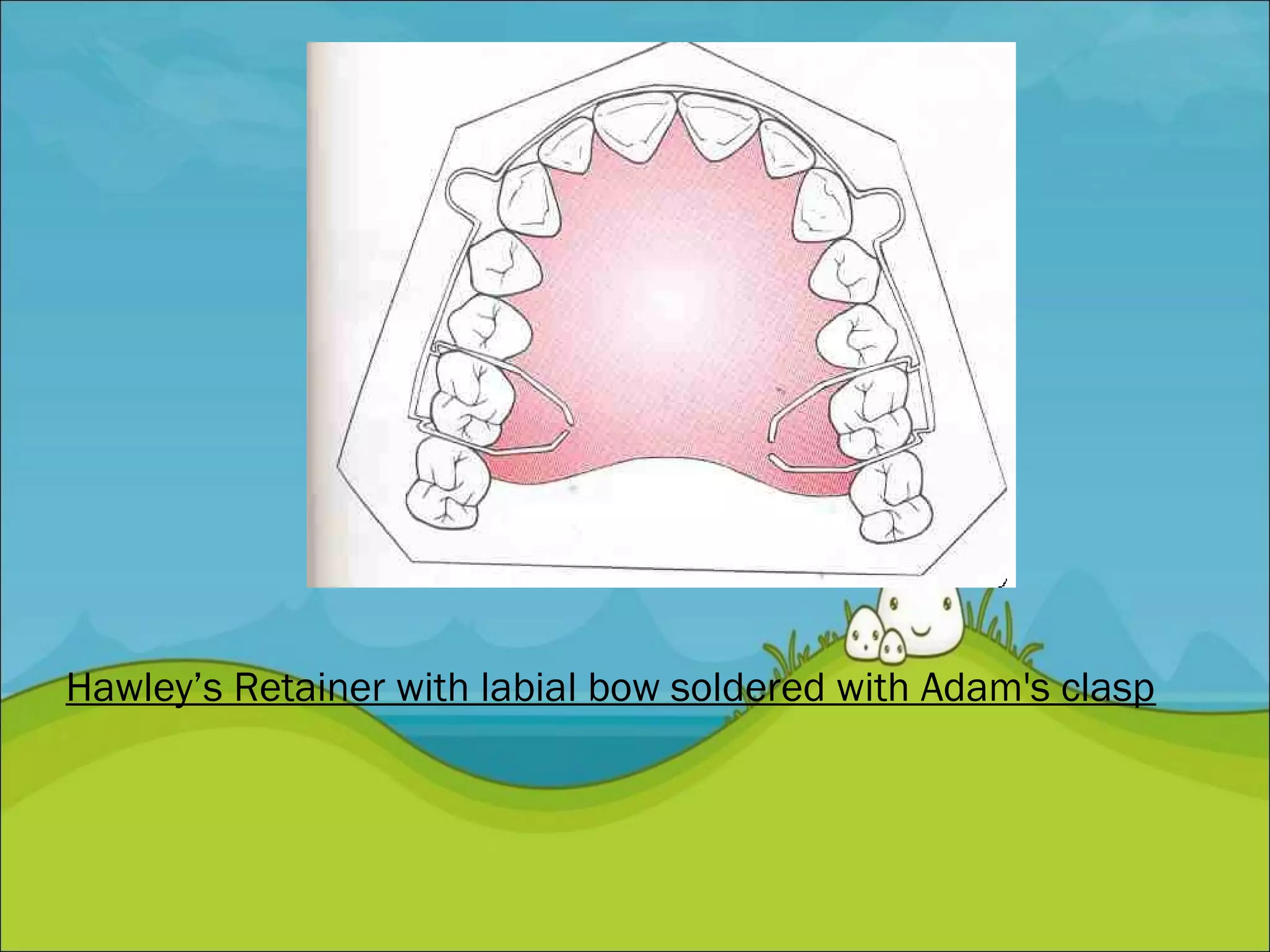 Retention and Relapse in orthodontics | PPT