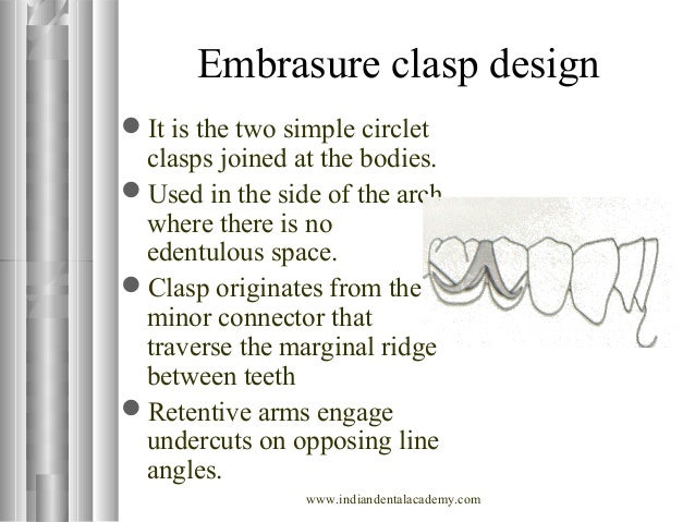 Clasp Retention in RPD / Labial orthodontics course