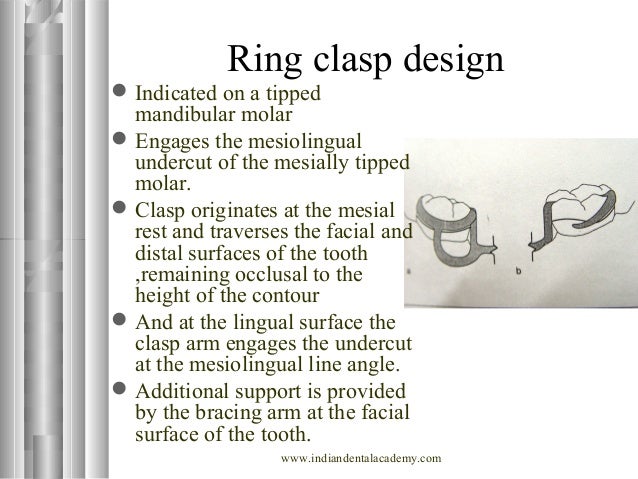Clasp Retention in RPD / Labial orthodontics course
