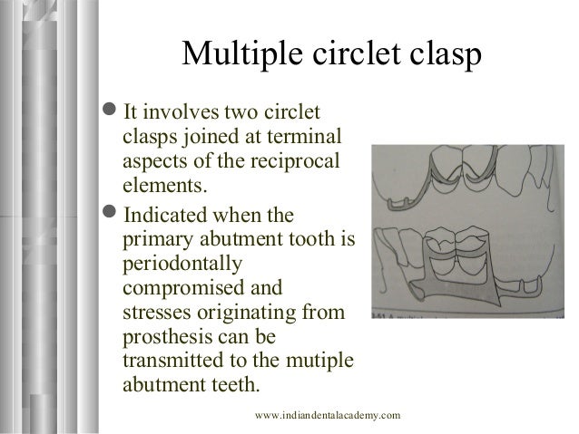 Clasp Retention in RPD / Labial orthodontics course