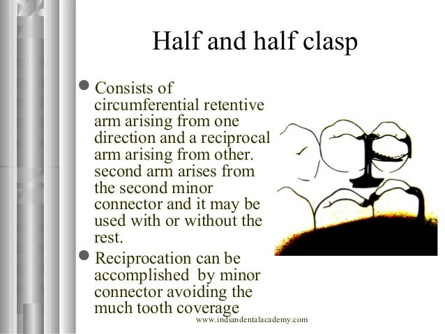 Clasp Retention in RPD / Labial orthodontics course