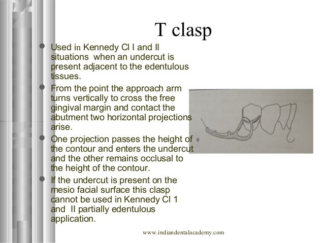 Clasp Retention in RPD / Labial orthodontics course