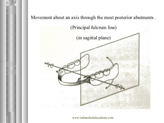 Clasp Retention in RPD / Labial orthodontics course