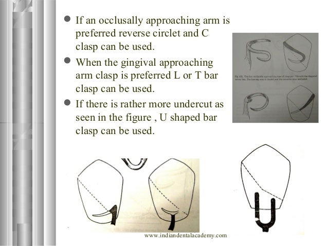 Clasp Retention in RPD / Labial orthodontics course