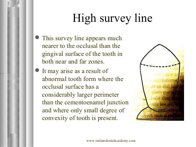 Clasp Retention in RPD / Labial orthodontics course