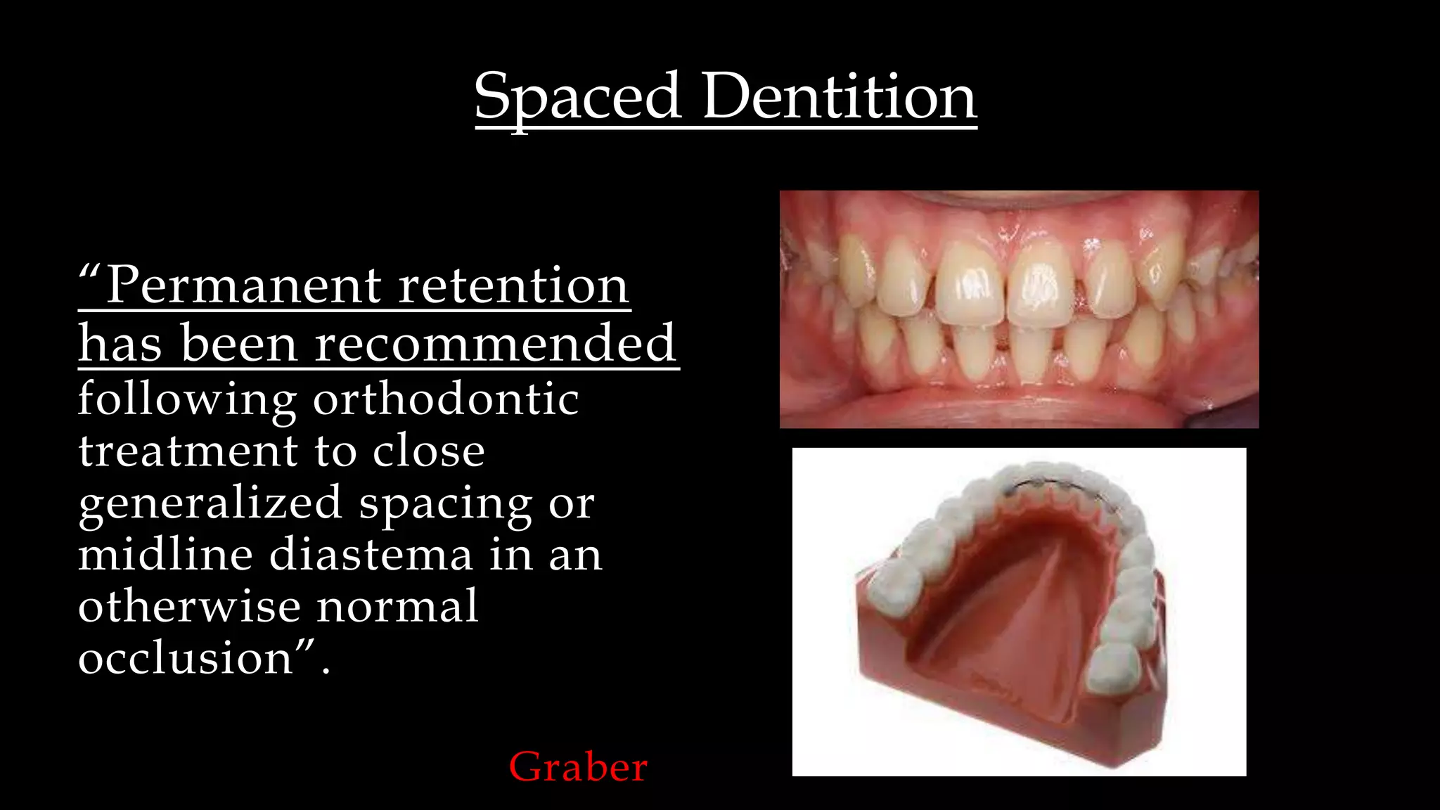 Retention dr-shareef shanableh | PPTX
