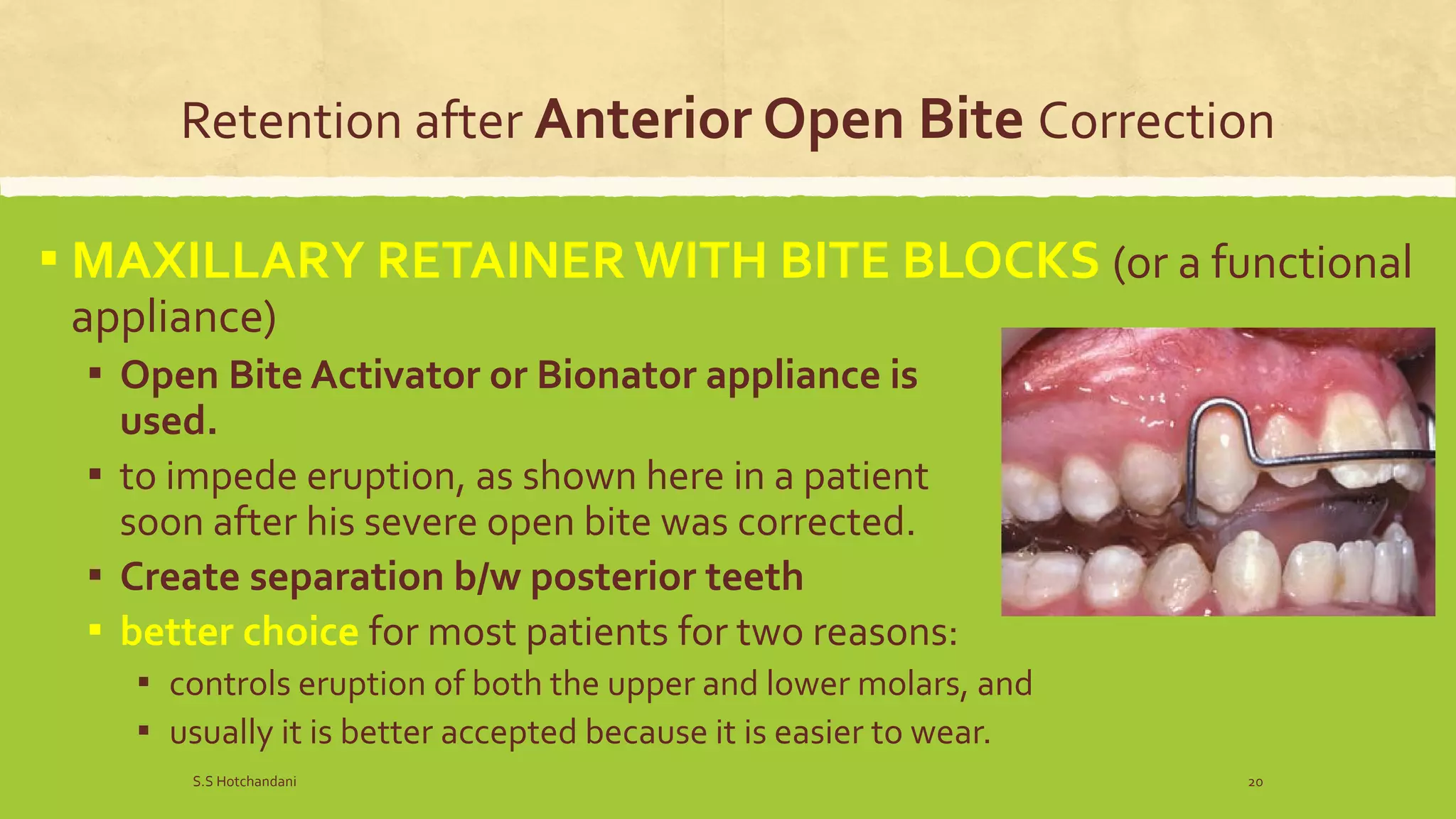 Retention in Orthodontics (Dentistry) | PDF
