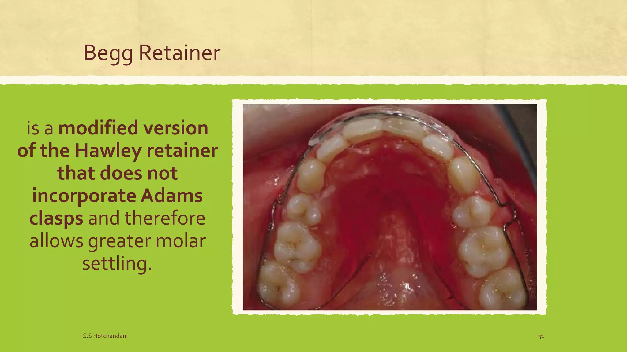 Retention in Orthodontics (Dentistry) | PDF
