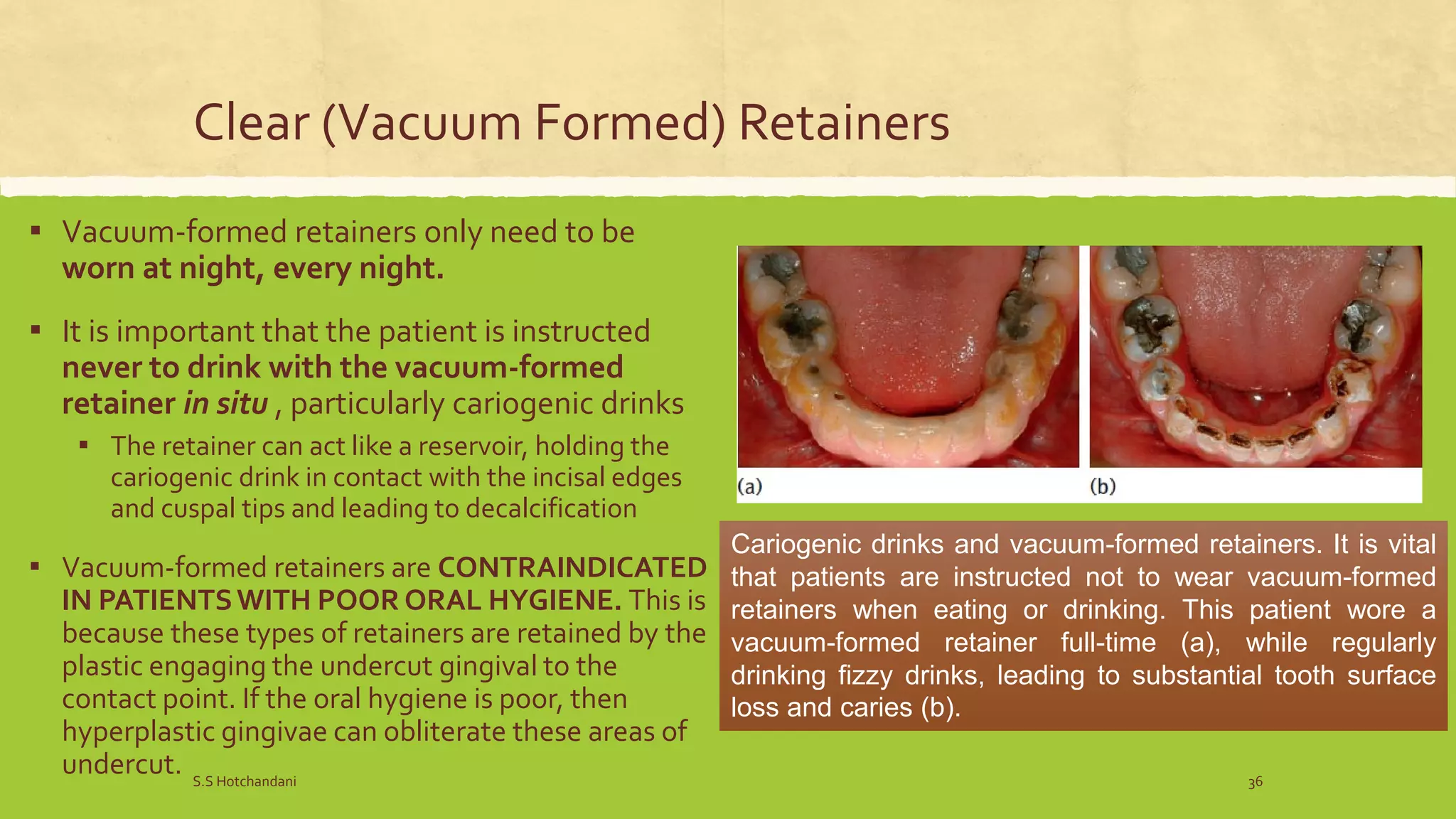 Retention in Orthodontics (Dentistry) | PDF