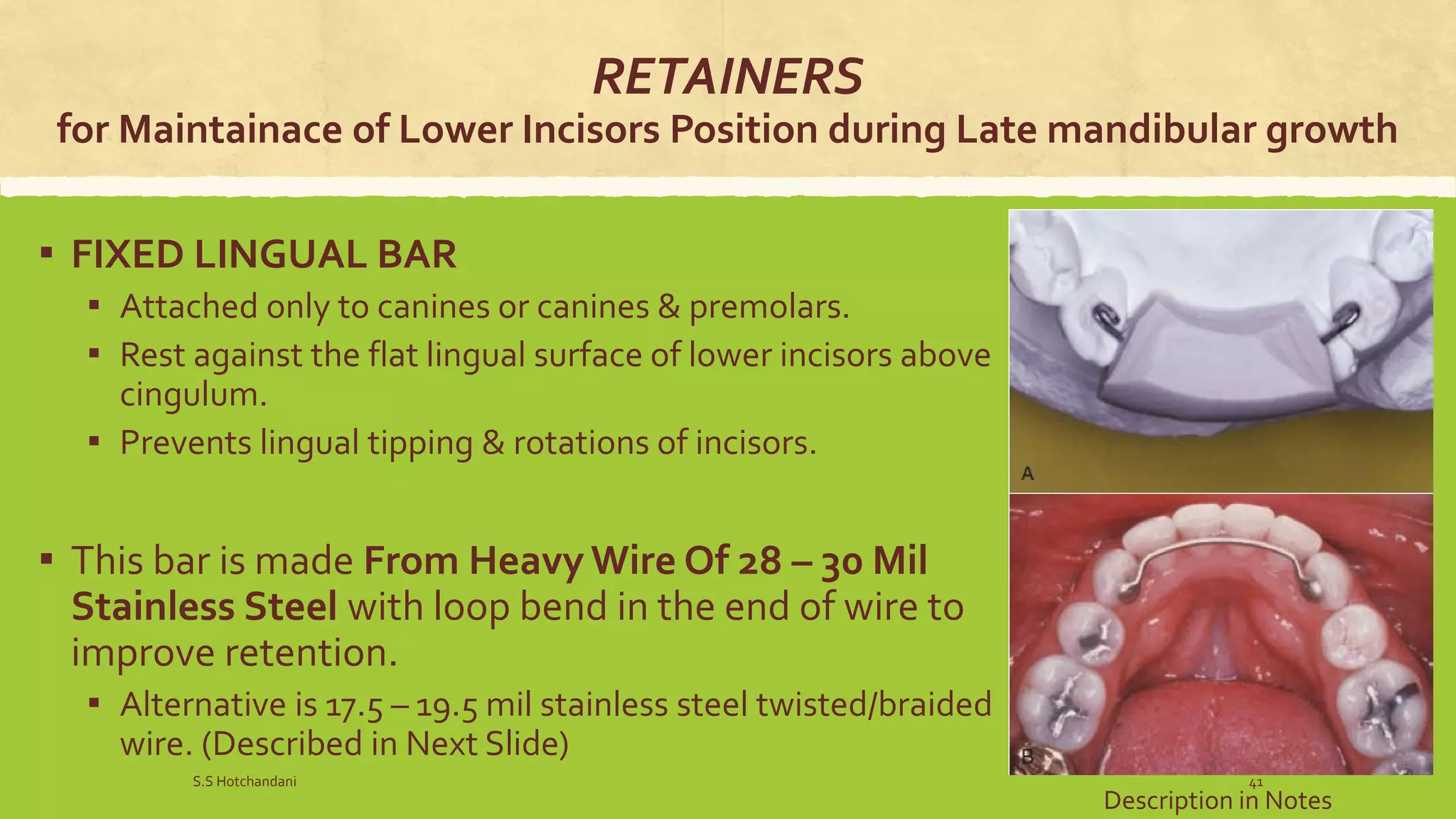 Retention in Orthodontics (Dentistry) | PDF