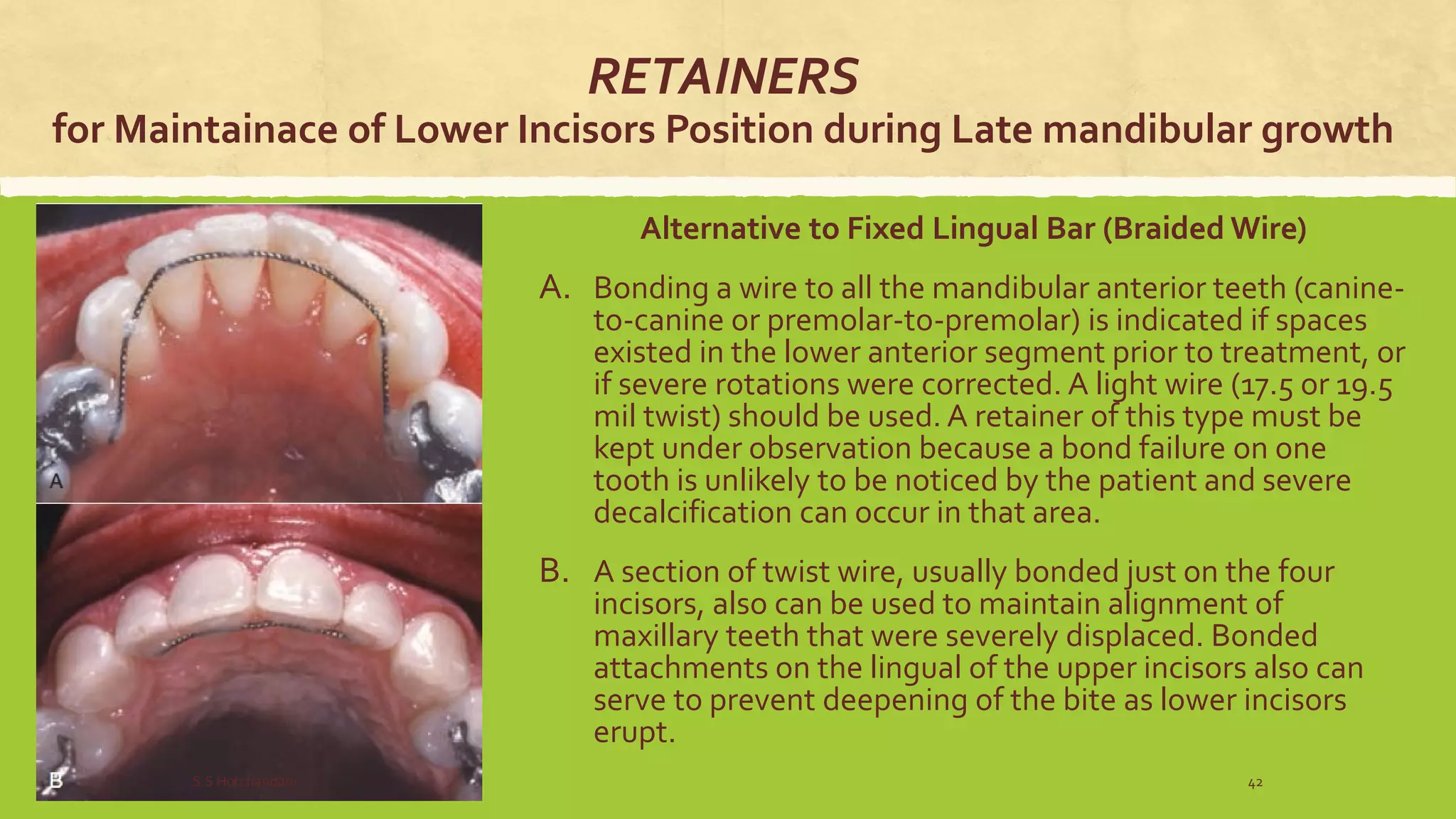 Retention in Orthodontics (Dentistry) | PDF