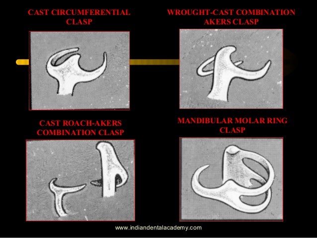 Retention mfp/ dental implant courses/ dental implant courses