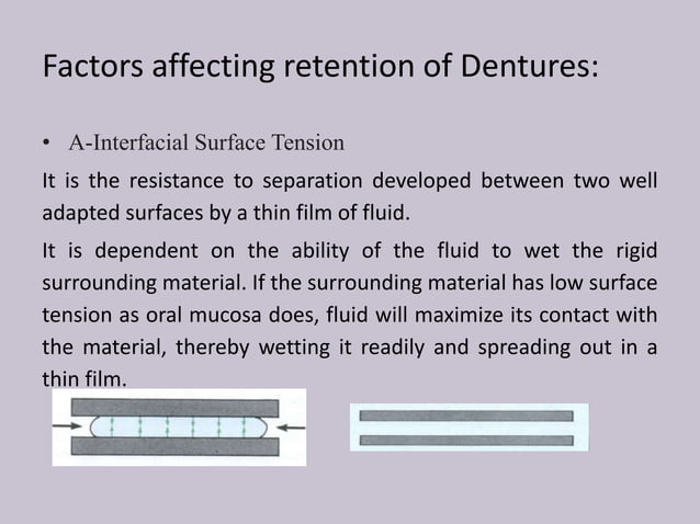 K-prosthodontic-lec3 Retention stability-and-support | PPT
