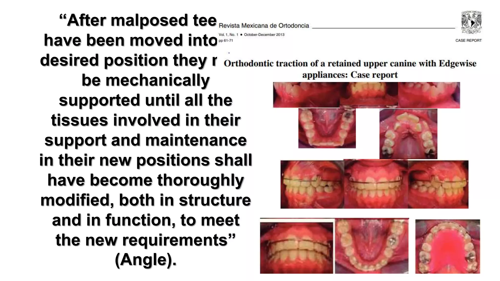 Retention after orthodontic therapy | PPTX