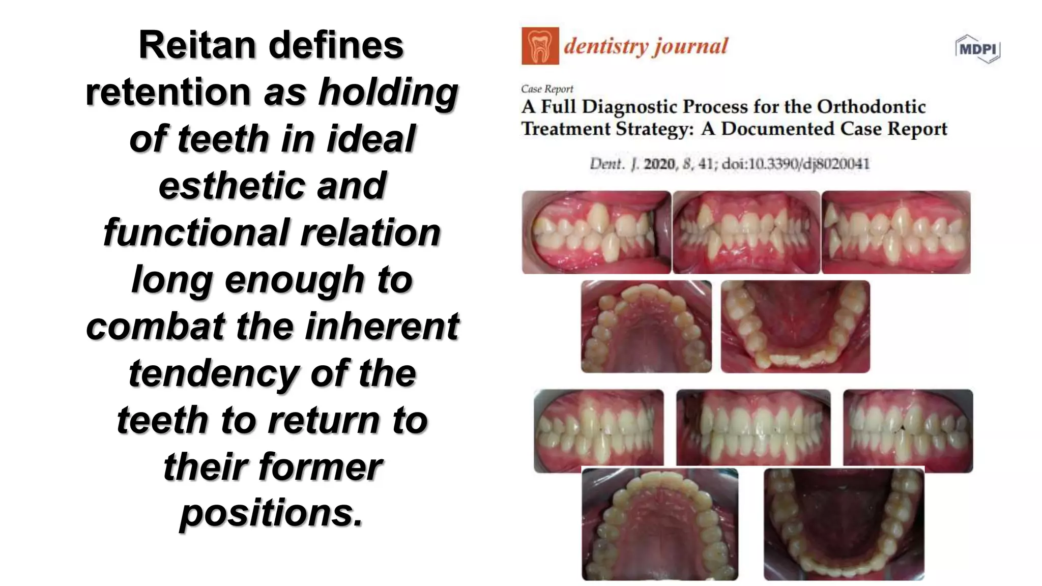 Retention after orthodontic therapy | PPTX