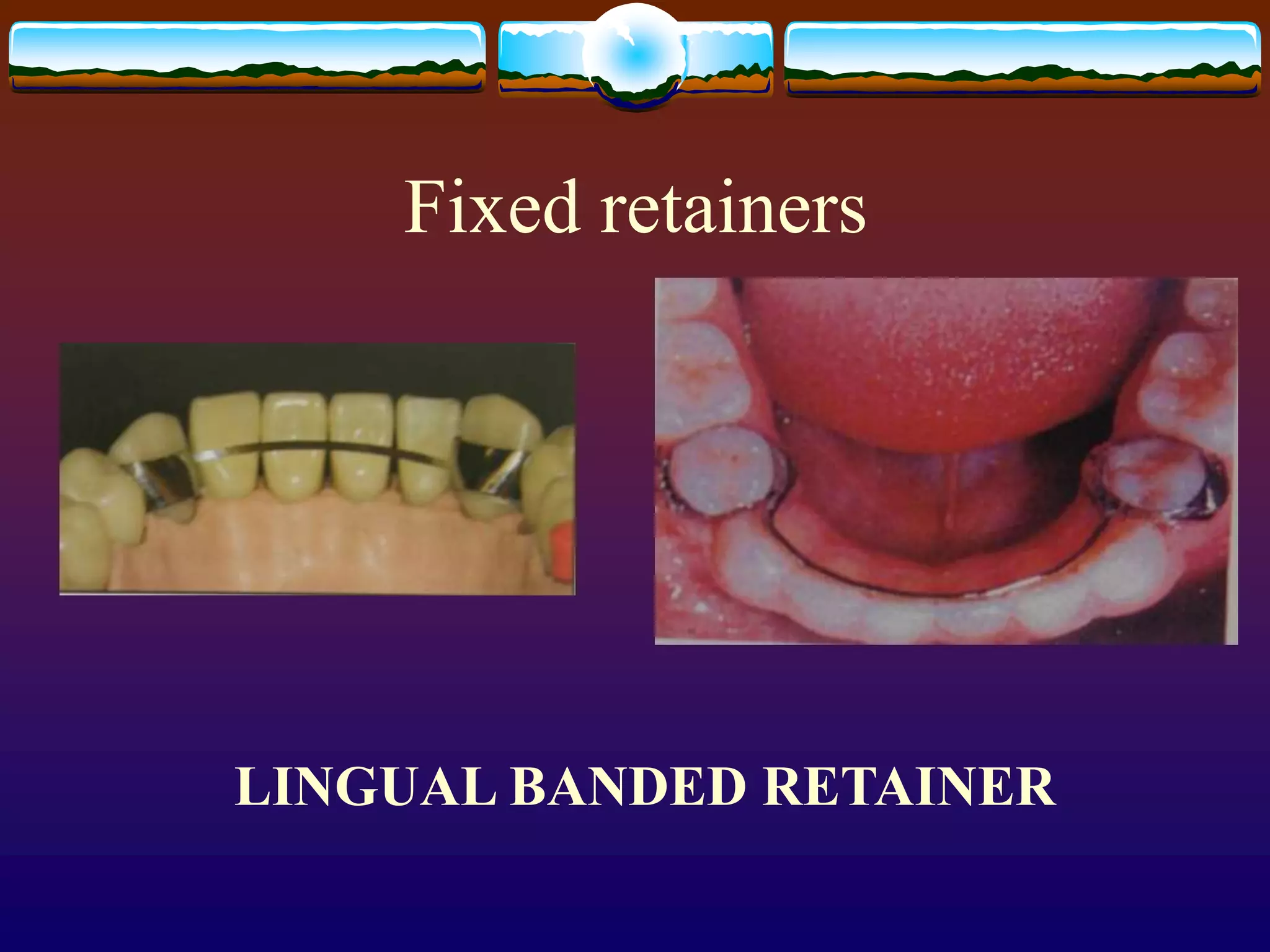 RETENTION AND RELAPSE O.ppt